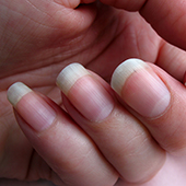 Trim Your Gross Nails